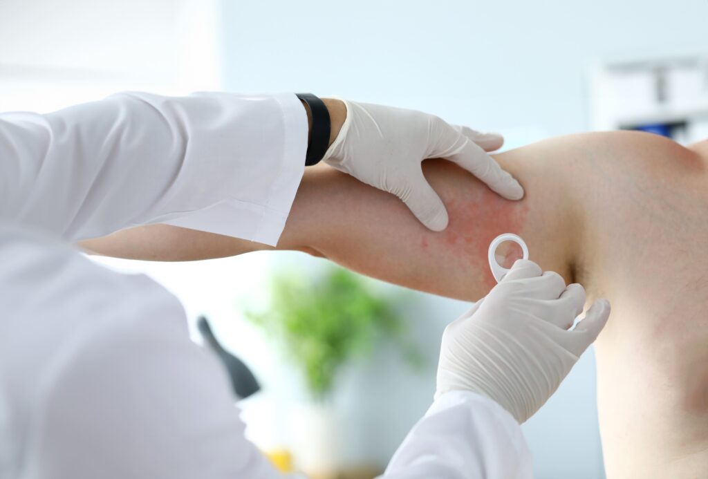 Psoriasis Treatment for a Clearer Future - Xemsis
